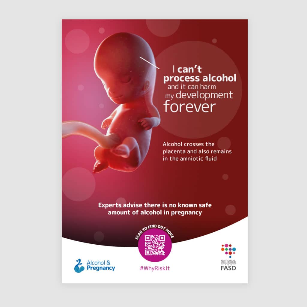 Alcohol & Pregnancy Posters (pack of 5) - National FASD